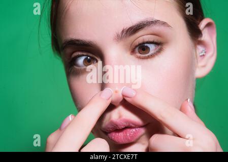 Woman squeeze out pimples on forehead. Acne and pimple on skin ...