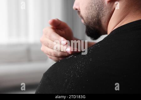 Man brushing dandruff off his sweater indoors, closeup. Space for text ...