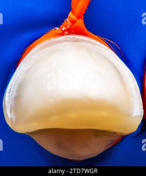 tooth minimal veneer preparation Stock Photo - Alamy