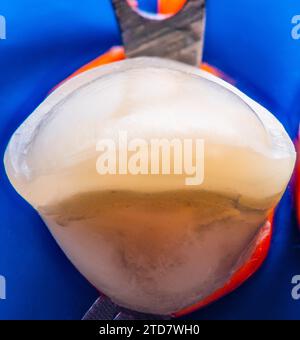 tooth minimal veneer preparation Stock Photo - Alamy