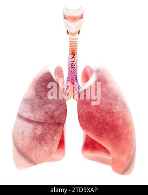 Acute and Chronic Inflammation Stock Photo - Alamy