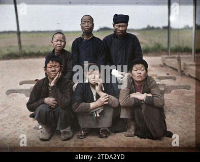 Yên-Duyên, Tonkin, Indochina a group of lepers in a leperosuria of the ...
