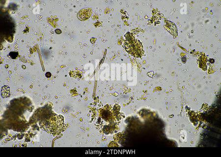 soil microorganism under the microscope recycling nutrients in a ...