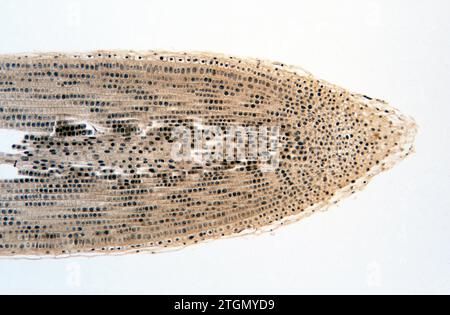 Calyptra or root cap protecting meristematic tissue of onion root ...