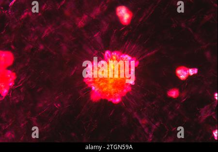 Sclereids are a kind of sclerenchyma, a support plant tissue. Pear ...