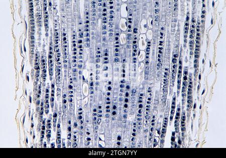 Root apical meristem showing cell divisions (mitosis). Onion root ...