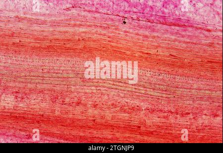 Pumpkin stem longitudinal section showing spiral tracheids (xylem ...