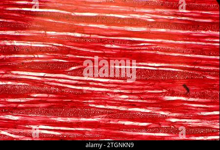 Tracheids are a kind of xylem. Photomicrograph, longitudinal section of ...