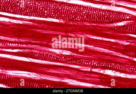 Tracheids are a kind of xylem. Photomicrograph, longitudinal section of ...