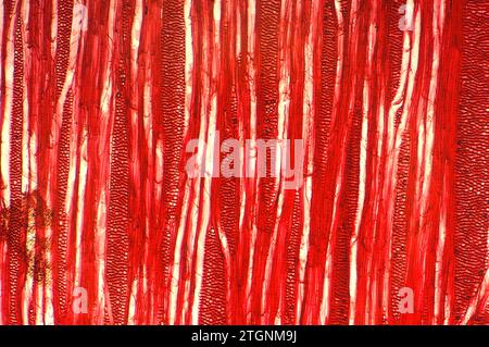 Tracheids are a kind of xylem. Photomicrograph, longitudinal section of ...