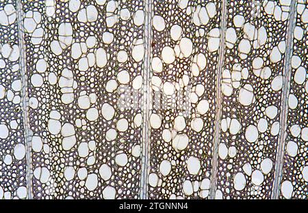 Stem cross section showing secundary xylem and radial parenchima ...