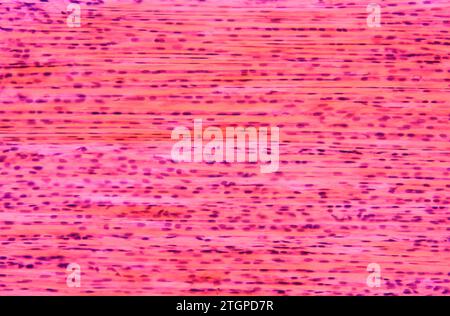 Dense connective tissue showing collagen fibers and fibroblasts ...