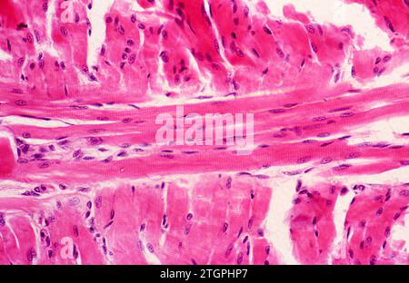 Skeletal muscle, longitudinal section. Photomicrograph Stock Photo - Alamy