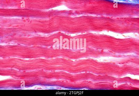 Skeletal muscle, longitudinal section. Photomicrograph Stock Photo - Alamy