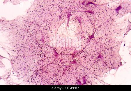 Axons of motor neurons. Photomicrograph Stock Photo - Alamy