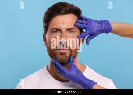 Doctor checking marks on man's face for cosmetic surgery operation ...
