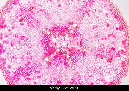 Sorrel root (cross section) showing epidermis, parenchyma, endodermis ...
