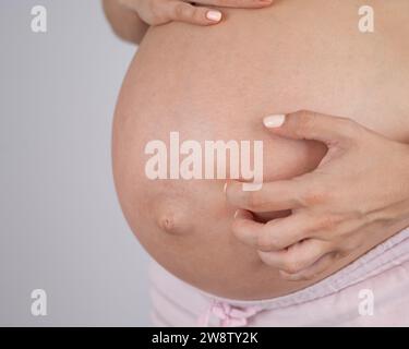 A woman scratches her stomach. Skin allergies during pregnancy Stock ...