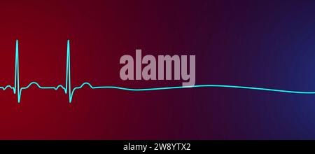 Asystole cardiac arrest, illustration Stock Photo - Alamy