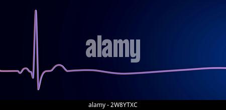 Asystole cardiac arrest, illustration Stock Photo - Alamy