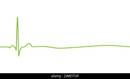 Asystole cardiac arrest, illustration Stock Photo - Alamy
