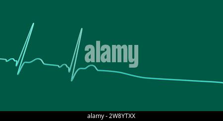 Asystole cardiac arrest, illustration Stock Photo - Alamy