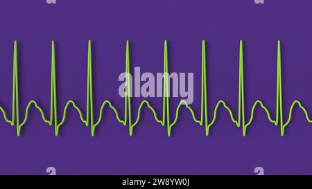 Atrial flutter abnormal heartbeat rhythm, illustration Stock Photo - Alamy
