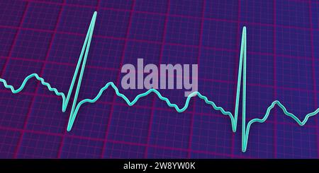 Illustration depicting an atrial flutter abnormal heart rhythm on an ...