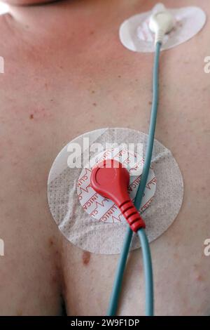 Electrocardiography. Close-up of electrodes on the chest of a patient ...