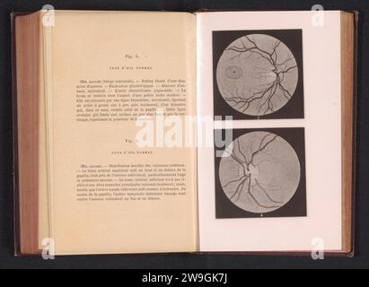 Photo production of two anatomical drawings of a normal eye, anonymous ...