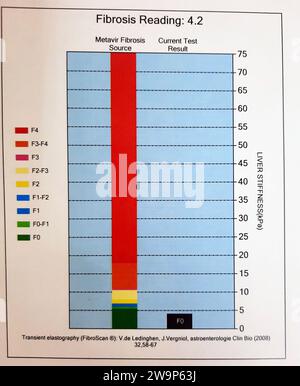 Fibroscan examination study of the liver revealed F0 for liver ...