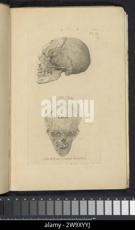Two views of a skull, anonymous, c. 1871 - In or Before 1881 ...