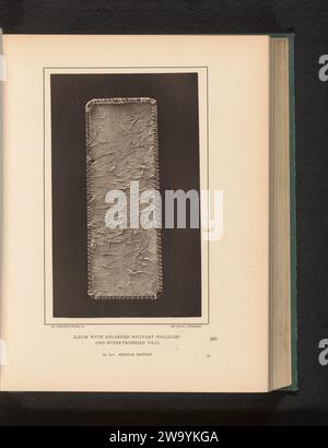 Stretched piece of winding arm with enlarged cavities, E.J. Ward, c ...