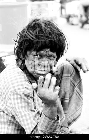 Portrait of a leper man taken in Hyderabad, India Stock Photo - Alamy