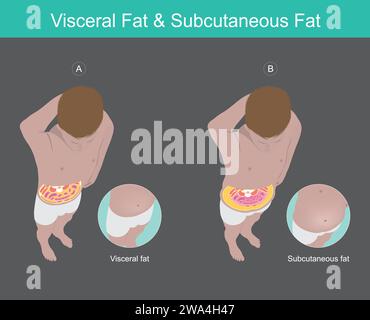 Subcutaneous and visceral fat diagram illustration Stock Vector Image ...