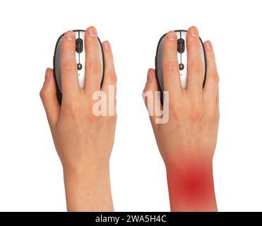 woman hand using ergonomic vertical mouse during working on Adjustable ...