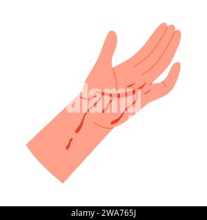 Disinfect injury on human hand. First medical aid for body wound ...