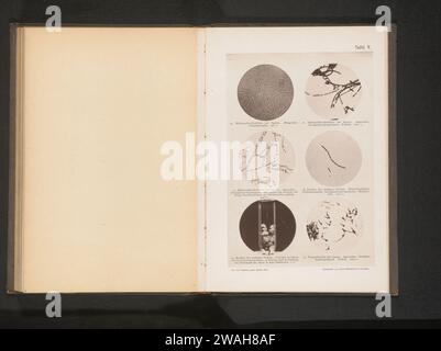 Six microscope recordings of bacteria, including the cholerabacteria ...