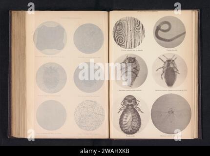 Overview of six microscopic magnifications. Above two hair worms, in ...