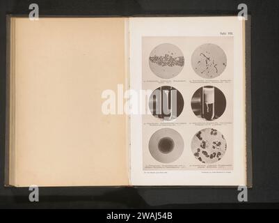 Six microscope recordings of bacteria, including tuberculosis and ...
