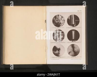 Six microscope recordings of bacteria, including tuberculosis and ...