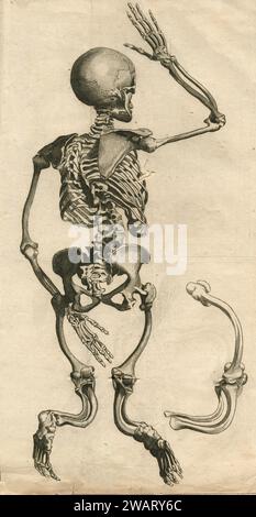 Vintage anatomy drawing: Deformed human skeleton, Transation ...