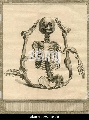 Vintage anatomy drawing: Deformed human skeleton, Transation ...