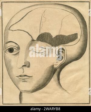 Vintage anatomy drawing: Deformed human skeleton, Transation ...