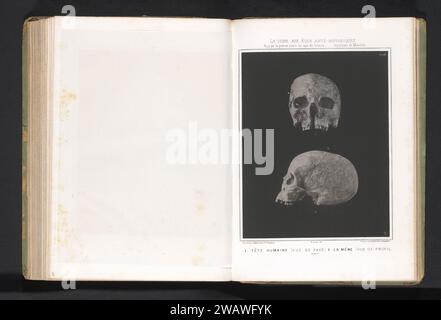 Two views of a human skull, Ville de Paris (Possible), c. 1864 - in or ...