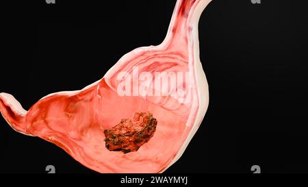 Cross section of human stomach diagram. 3d illustration Stock Photo - Alamy