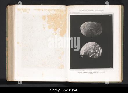 Two views of a human skull, Ville de Paris, c. 1864 - in or before 1869 ...