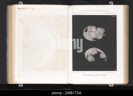 Two views of a human skull, Ville de Paris, c. 1864 - in or before 1869 ...