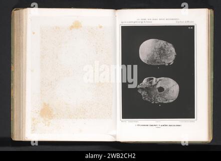 Two views of a human skull, Ville de Paris, c. 1864 - in or before 1869 ...