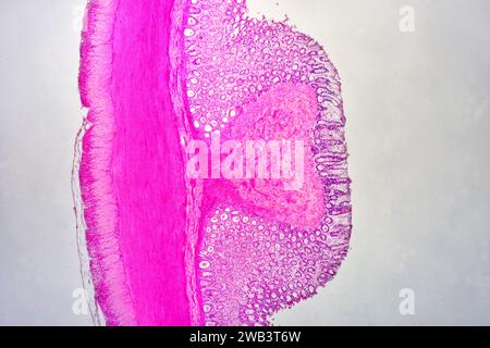 Human vermiform appendix cross section showing (left to right ...